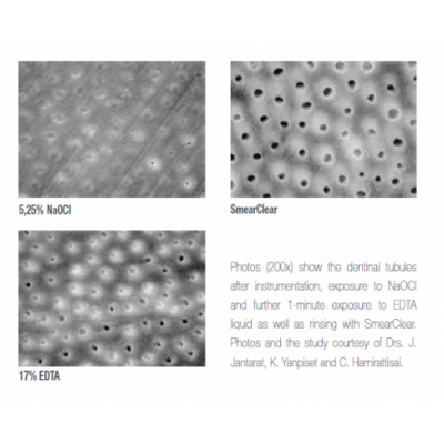 Buy Genuine and Authenticate Product of KERR Direct from ...