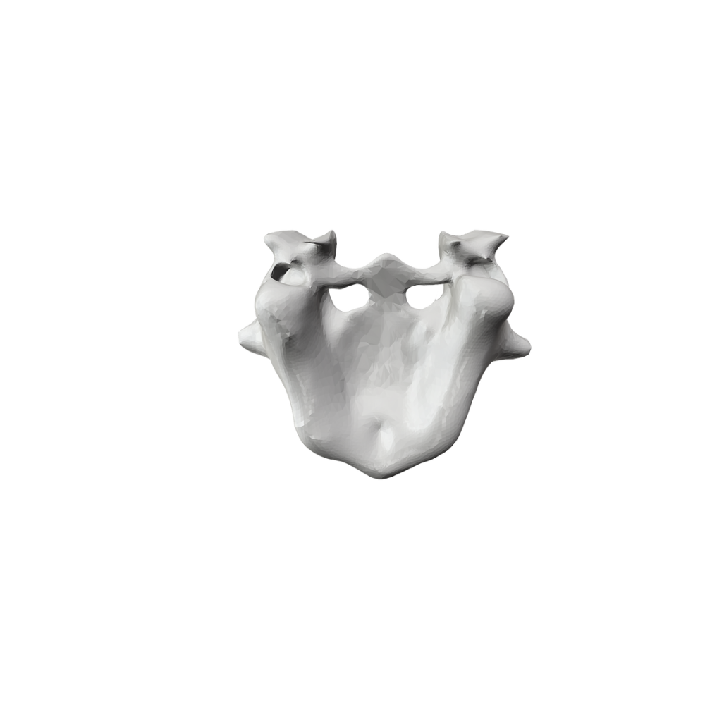 Buy Completely Edentulous Maxilla V-Invent Online at Lowest ...