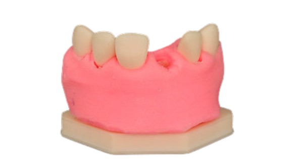 Buy Partial Extraction Technique V-Invent Online at Lowest ...