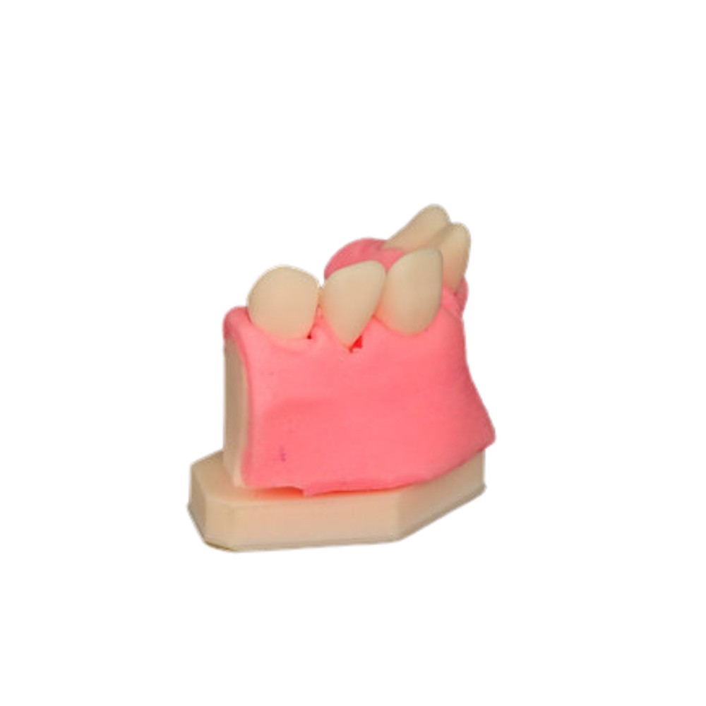 Buy Partial Extraction Technique V-Invent Online at Lowest ...