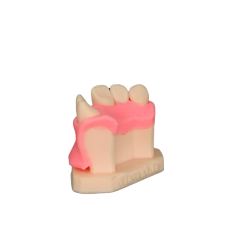 Buy Partial Extraction Technique V-Invent Online at Lowest ...