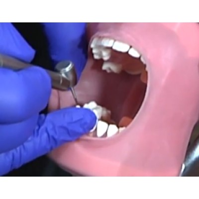 Buy M4 Safety Hand Piece Kerr Online at Lowest Best Price ...