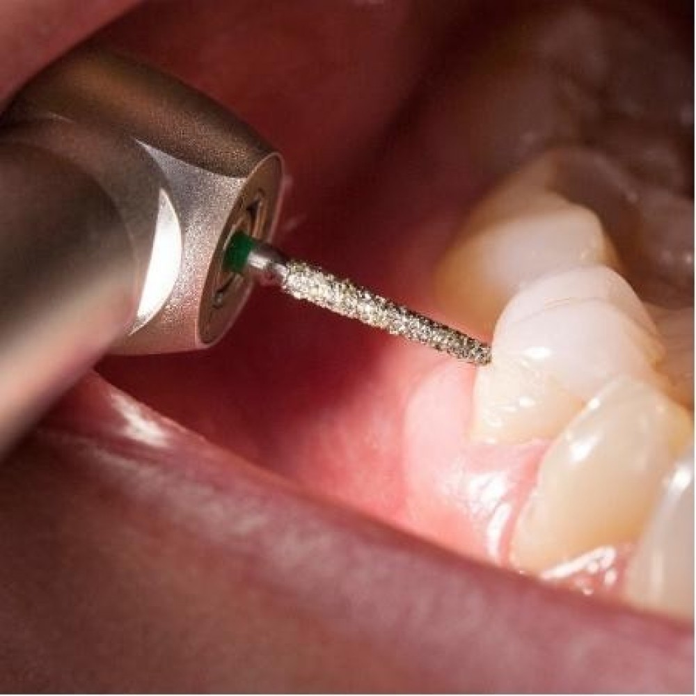 Buy LED Air Rotor Handpiece WALDENT Online at Lowest Best ...