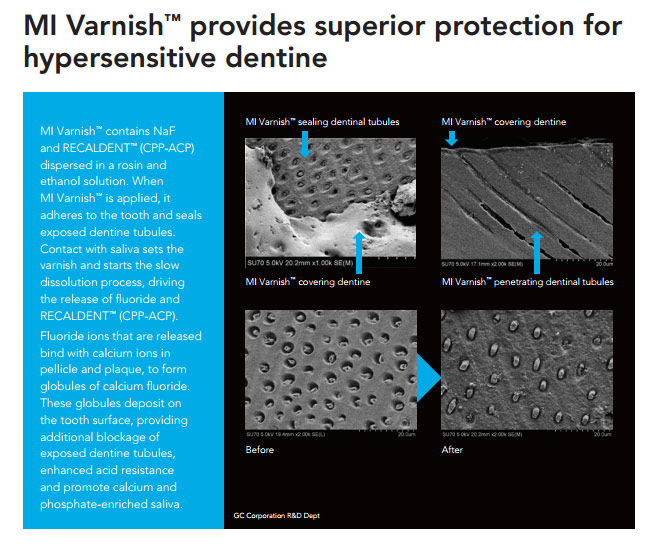 Buy MI Varnish GC Online at Lowest Best Price Guaranteed ...