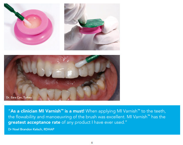 Buy MI Varnish GC Online at Lowest Best Price Guaranteed ...