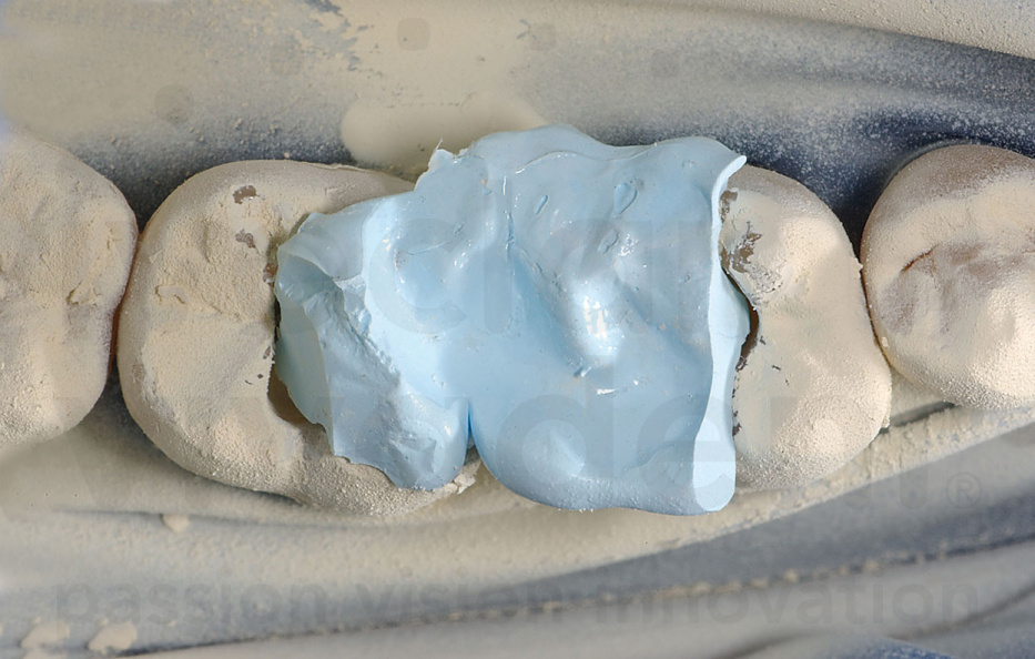 Buy Virtual CAD Bite Registration Ivoclar-Vivadent Online ...