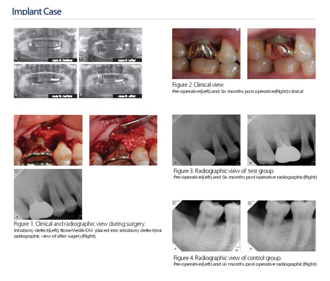Buy DM Bone METABIOMED Online at Lowest Best Price Guaranteed ...